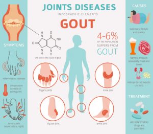 Gout | Surrey Total Health